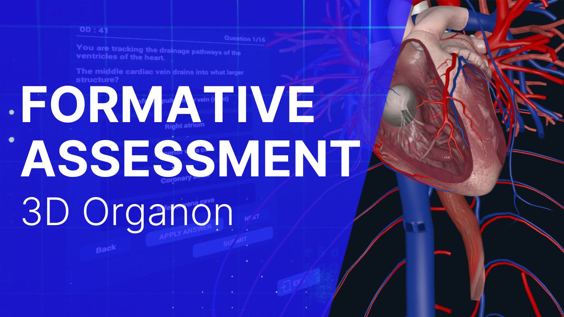 Formative Assessment
