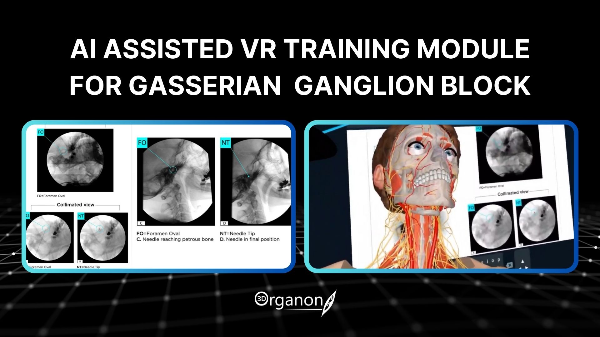 Interventional Pain Training