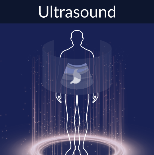 Ultrasound Simulator