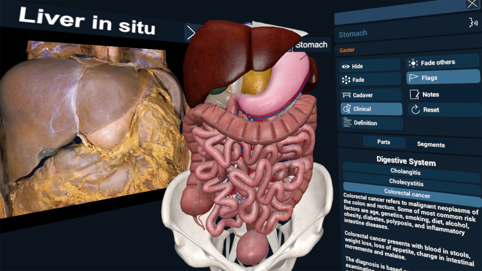 Revolutionizing Anatomy Education with XR and AI: How 3D Organon is ...